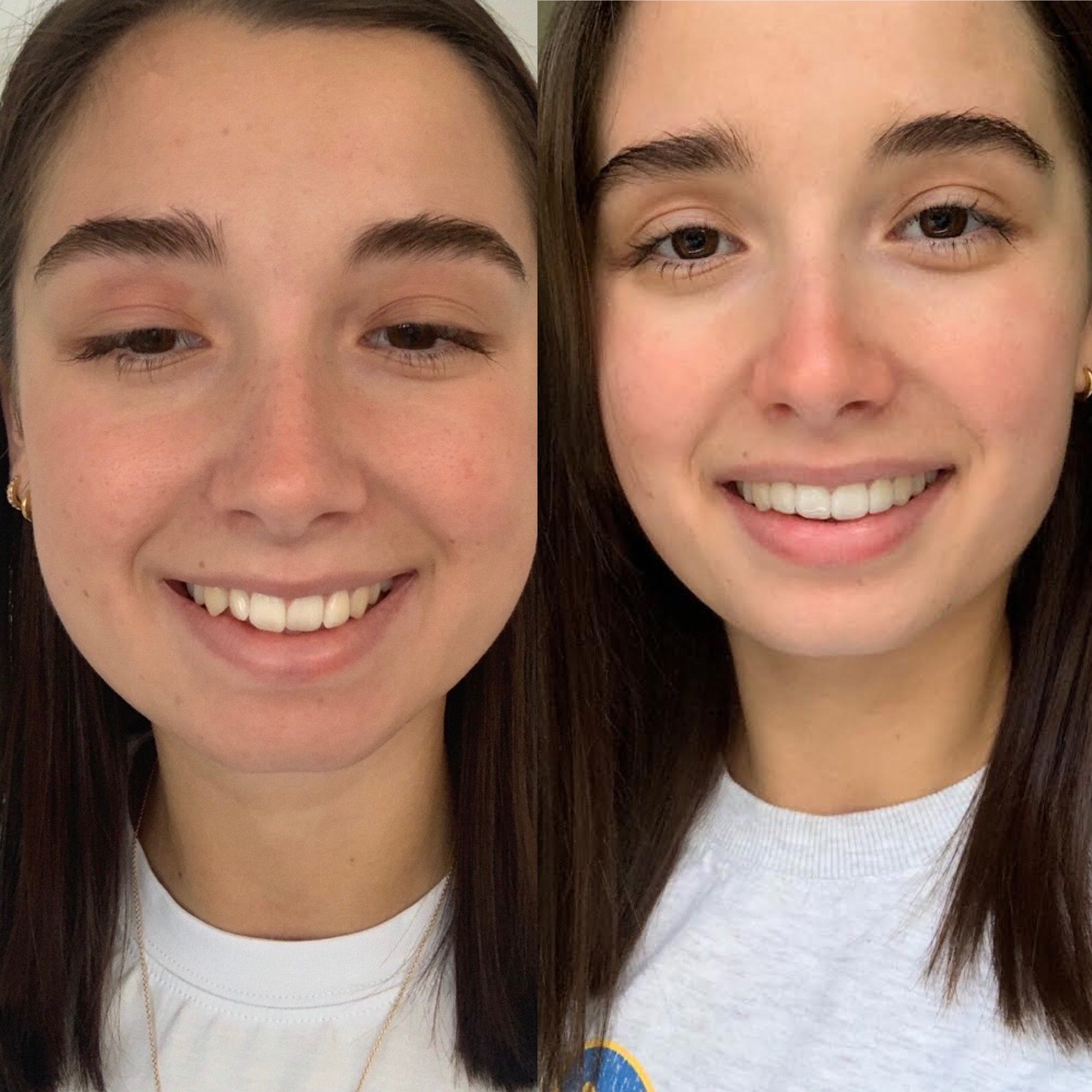 Results In Under 6 Months - Bitesoft Co.