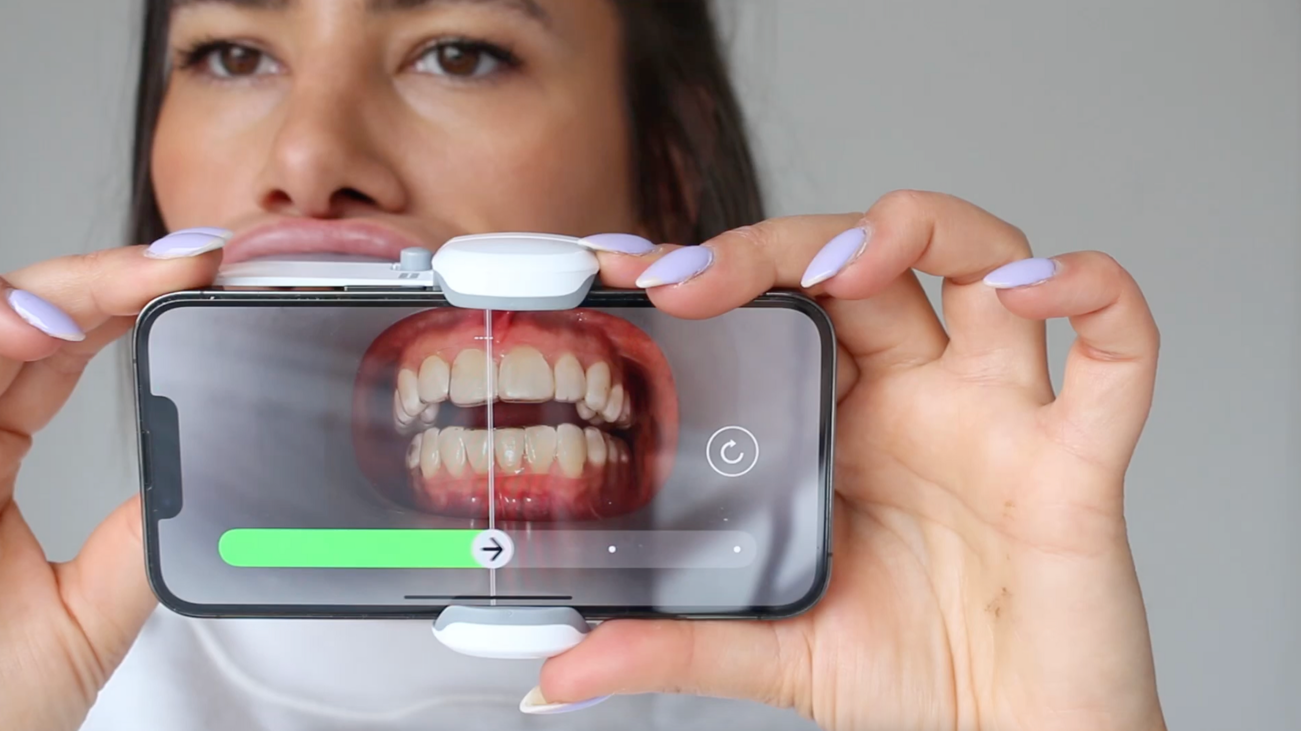 ScanBox Pro Dental Monitoring Australia | Bitesoft Co – bitesoft dental