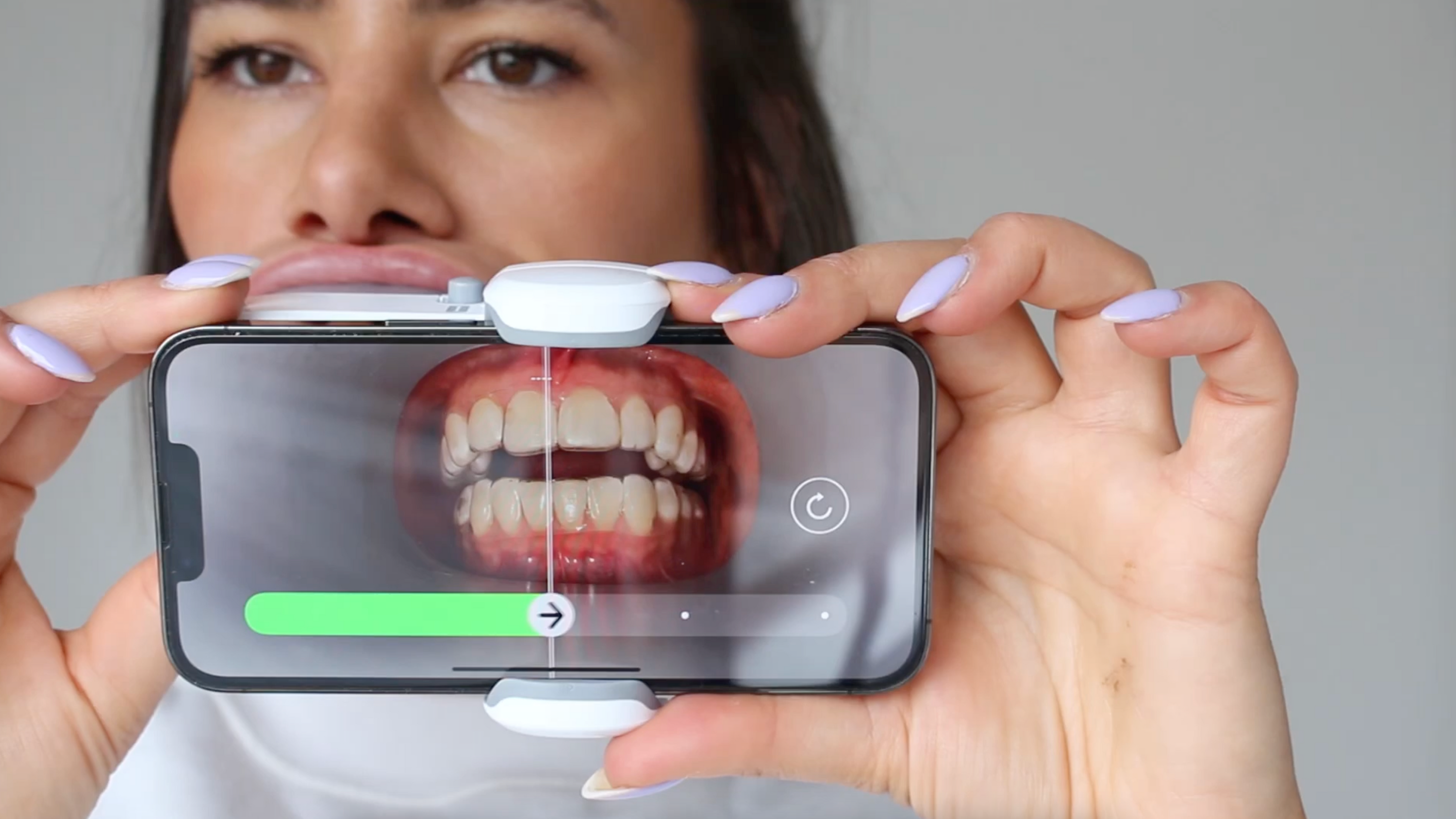 ScanBox Pro Dental Monitoring Australia | Bitesoft Co – bitesoft dental