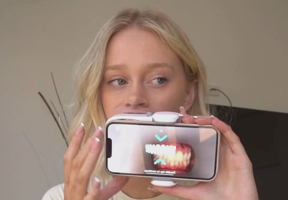 ScanBox Pro Dental Monitoring Australia | Bitesoft Co – bitesoft dental