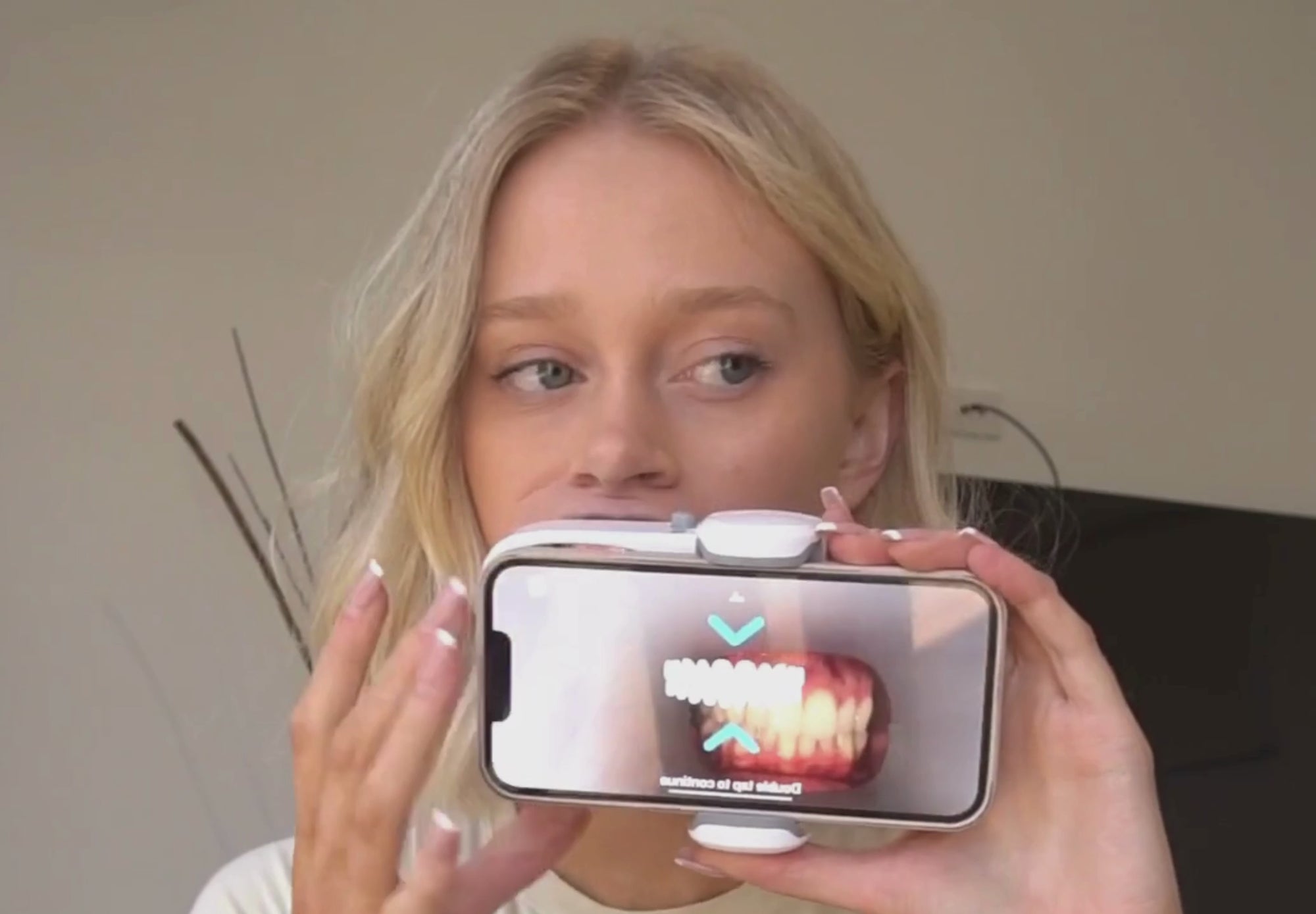 ScanBox Pro Dental Monitoring Australia | Bitesoft Co – bitesoft dental